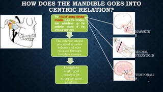 ANATOMY OF TMJ AND ITS ROLE IN PROSTHODONTICS.pptx