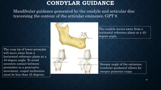 ANATOMY OF TMJ AND ITS ROLE IN PROSTHODONTICS.pptx