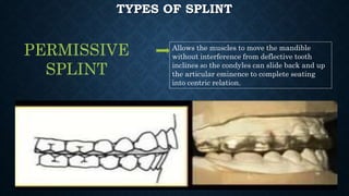 ANATOMY OF TMJ AND ITS ROLE IN PROSTHODONTICS.pptx