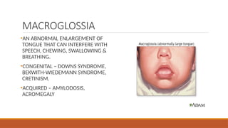 ANATOMY OF TONGUE presentation otorhinolaryngology | PPTX