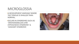 ANATOMY OF TONGUE presentation otorhinolaryngology | PPTX