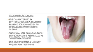 ANATOMY OF TONGUE presentation otorhinolaryngology | PPTX