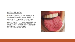 ANATOMY OF TONGUE presentation otorhinolaryngology | PPTX