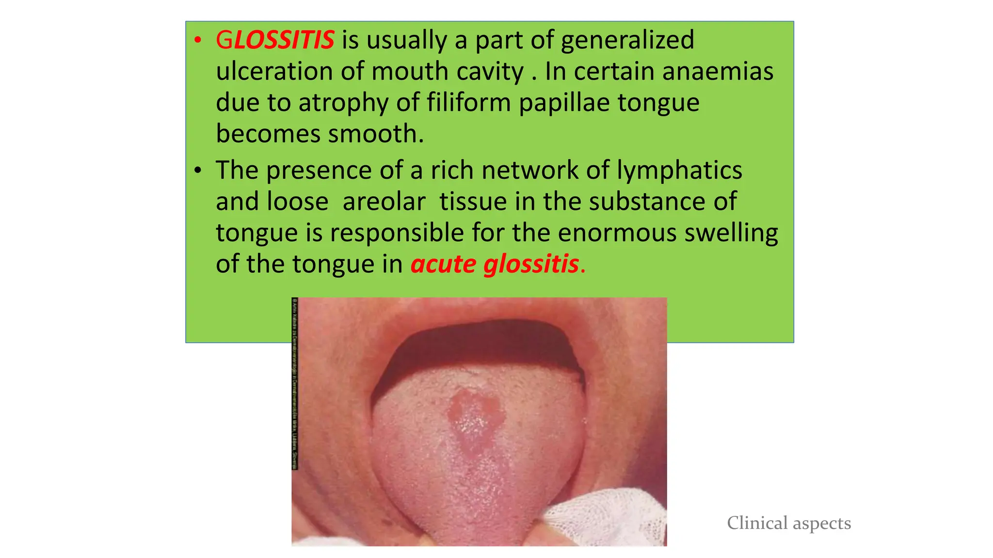 Anatomy of Tongue - Part 2.pptx