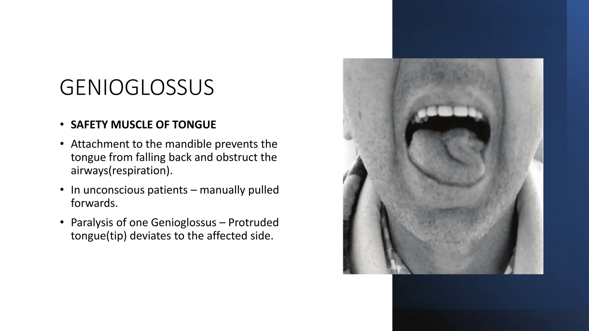 Anatomy of Tongue - Part 2.pptx