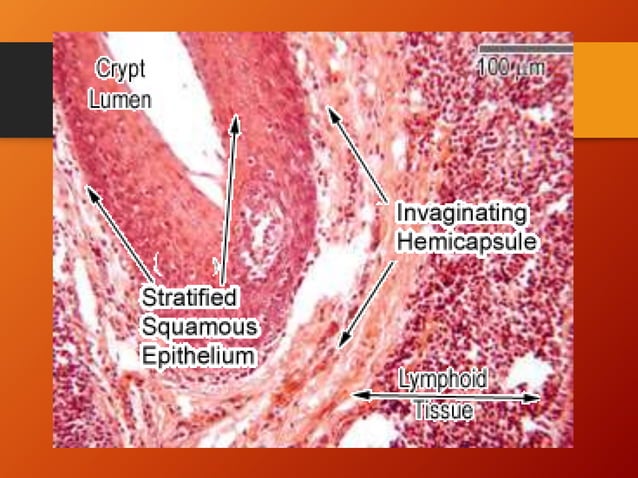 Anatomy of tonsil and oropharynx | PPTX | Ear, Nose and Throat ...