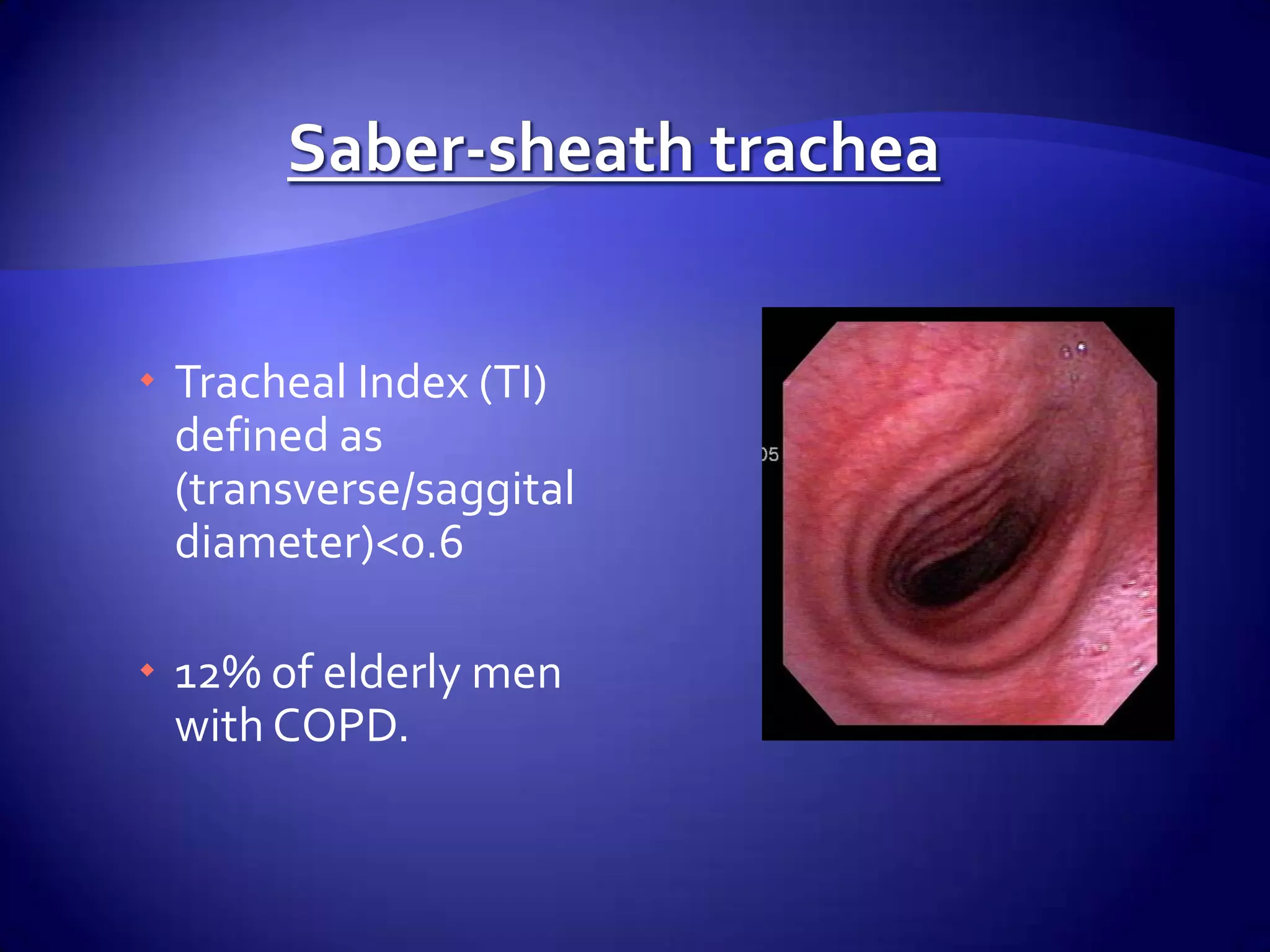 ANATOMY OF TRACHEA & TRACHEOSTOMY | PPTX