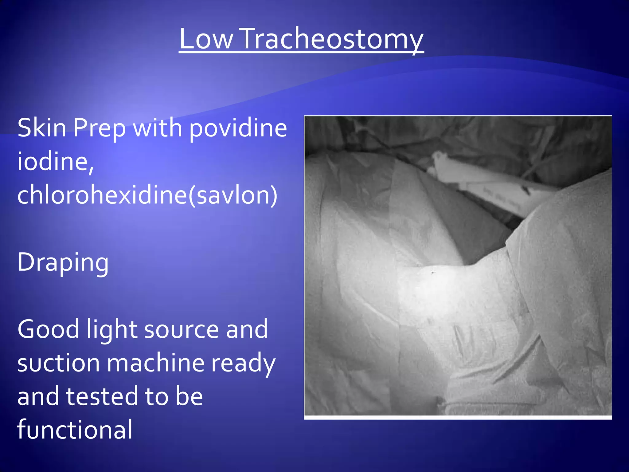 ANATOMY OF TRACHEA & TRACHEOSTOMY | PPTX