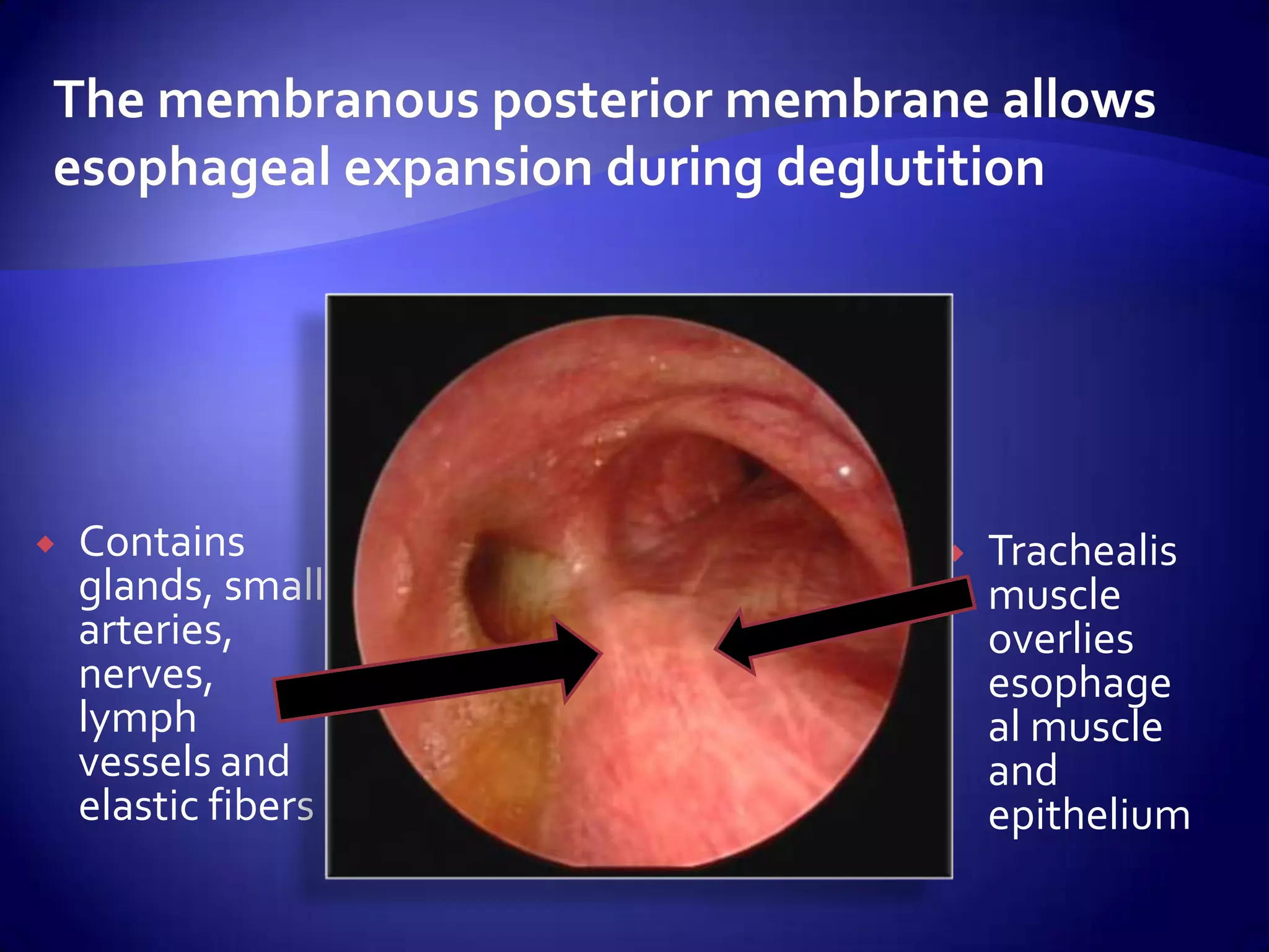 ANATOMY OF TRACHEA & TRACHEOSTOMY | PPTX