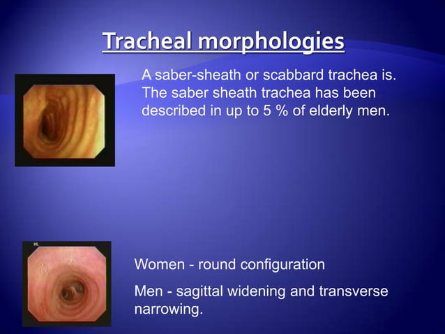ANATOMY OF TRACHEA & TRACHEOSTOMY | PPTX