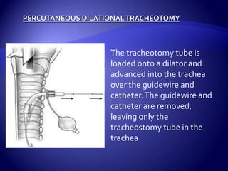 ANATOMY OF TRACHEA & TRACHEOSTOMY | PPTX