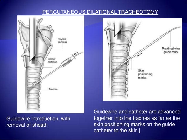 ANATOMY OF TRACHEA & TRACHEOSTOMY