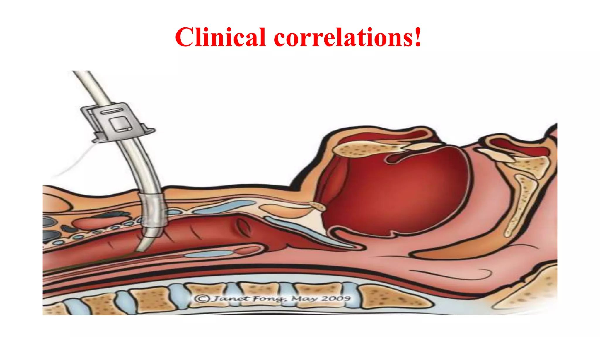 anatomy of trachea.pptx