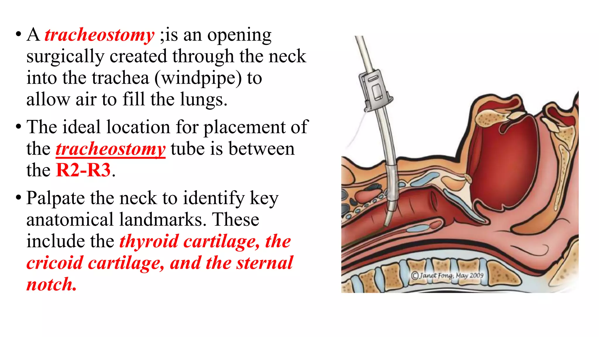 anatomy of trachea.pptx