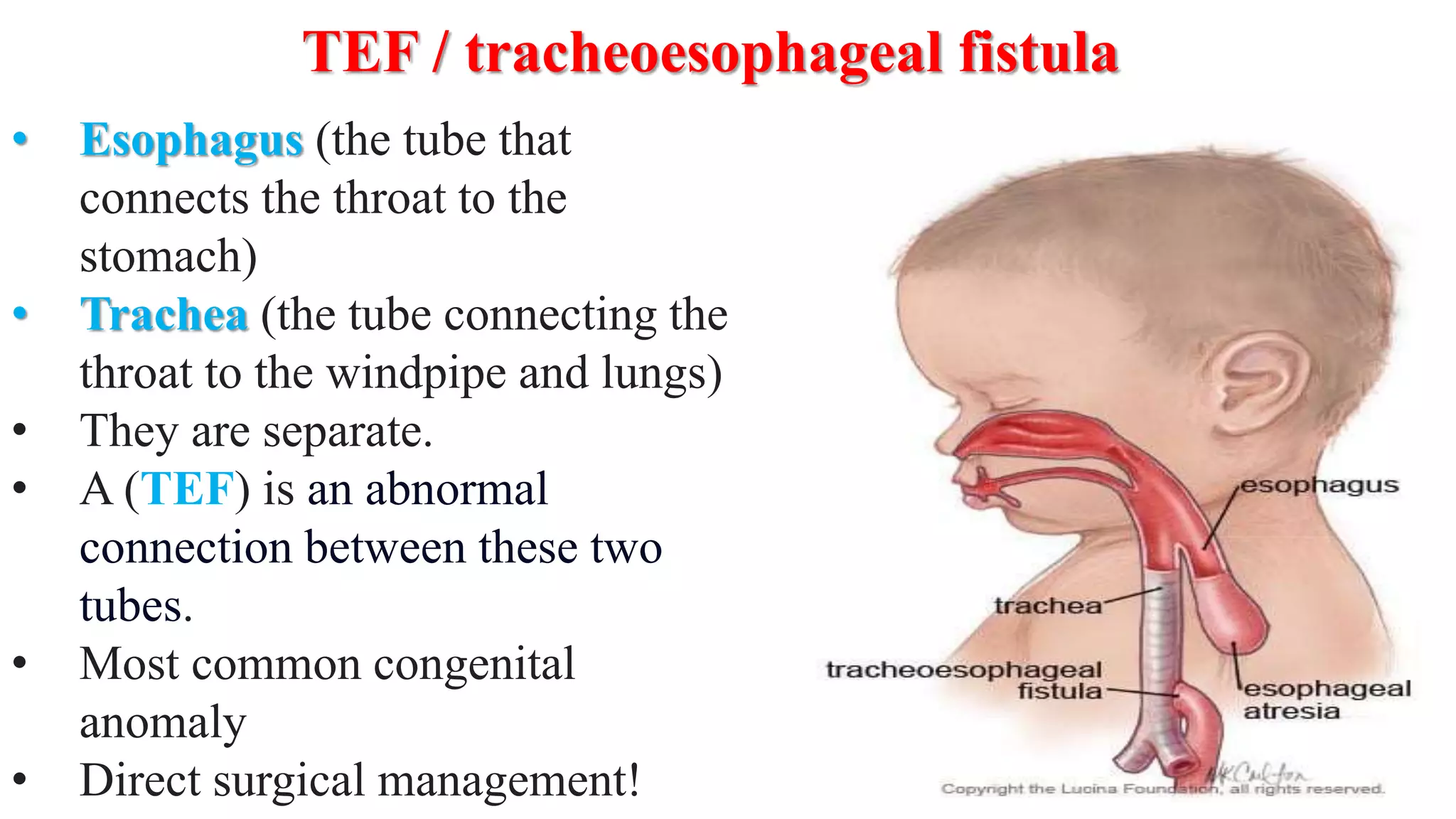 anatomy of trachea.pptx