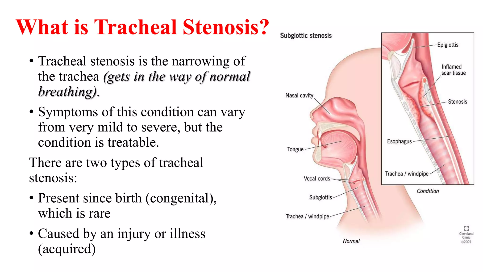 anatomy of trachea.pptx