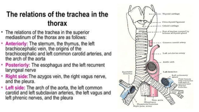 anatomy of trachea.pptx