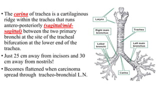 anatomy of trachea.pptx