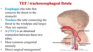 anatomy of trachea.pptx