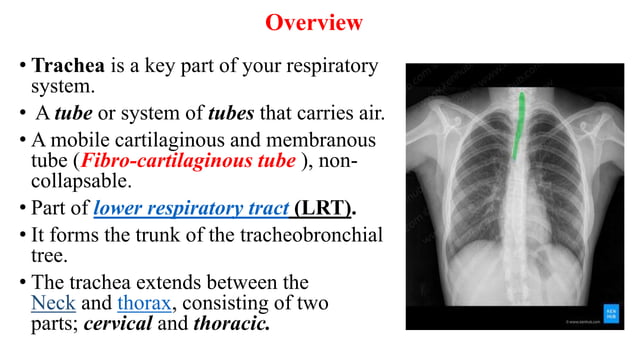 anatomy of trachea.pptx