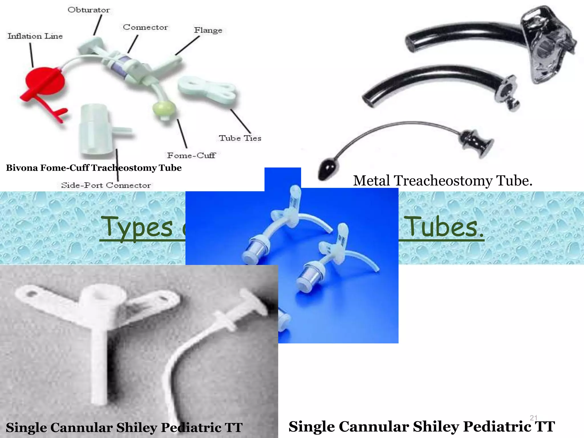 Anatomy of trachea & tracheostomy ----- | PPT
