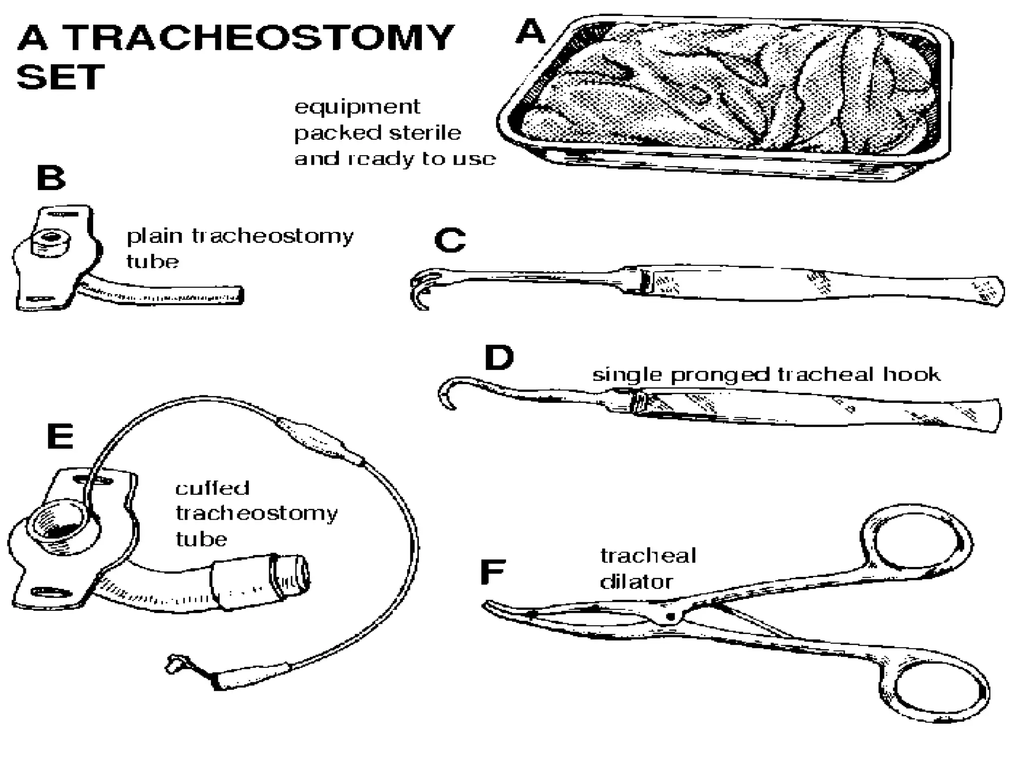 Anatomy of trachea & tracheostomy ----- | PPT