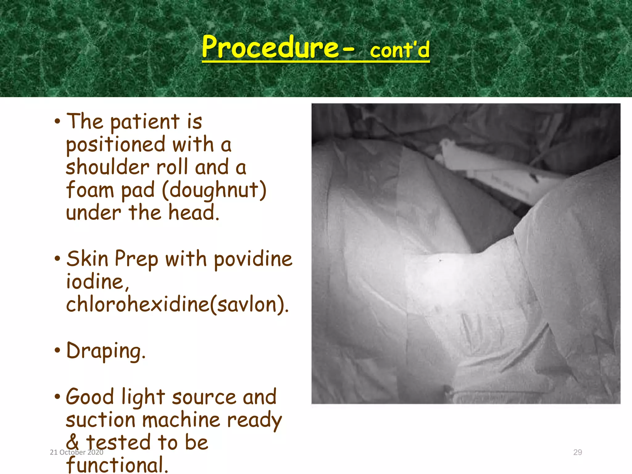Anatomy of trachea & tracheostomy ----- | PPT