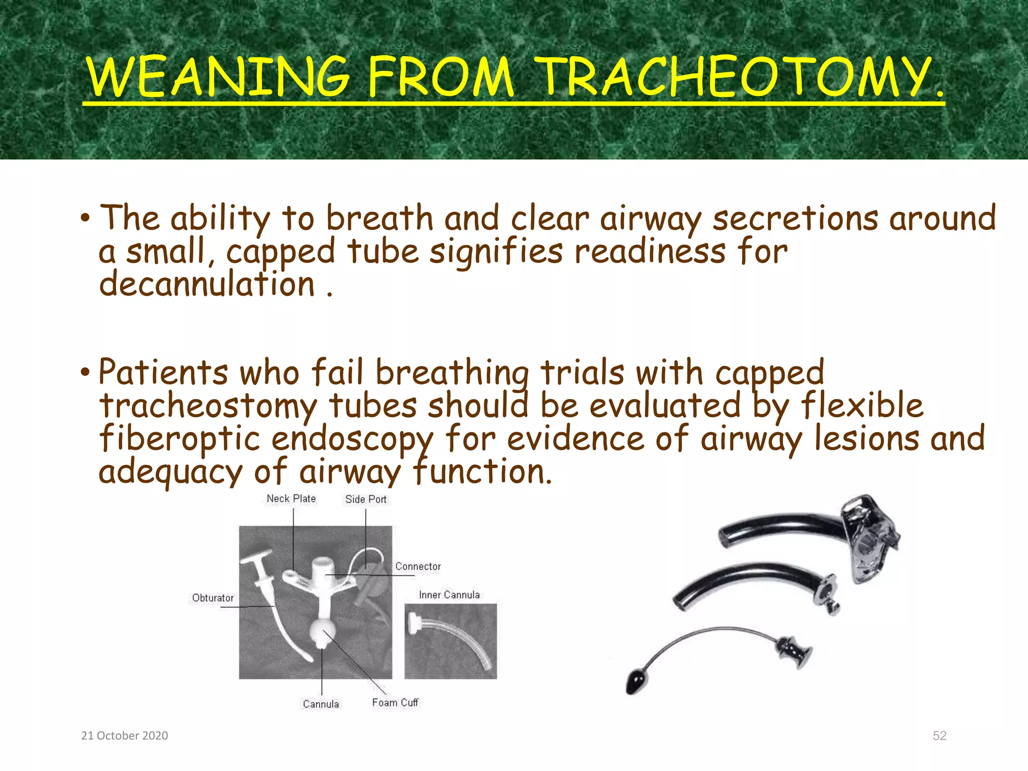 Anatomy of trachea & tracheostomy ----- | PPT