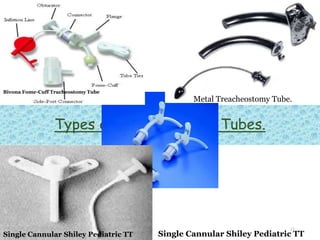 Anatomy of trachea & tracheostomy ----- | PPT | Lung and Respiratory ...