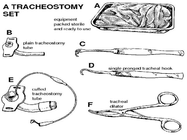 Anatomy of trachea & tracheostomy ----- | PPT | Lung and Respiratory ...