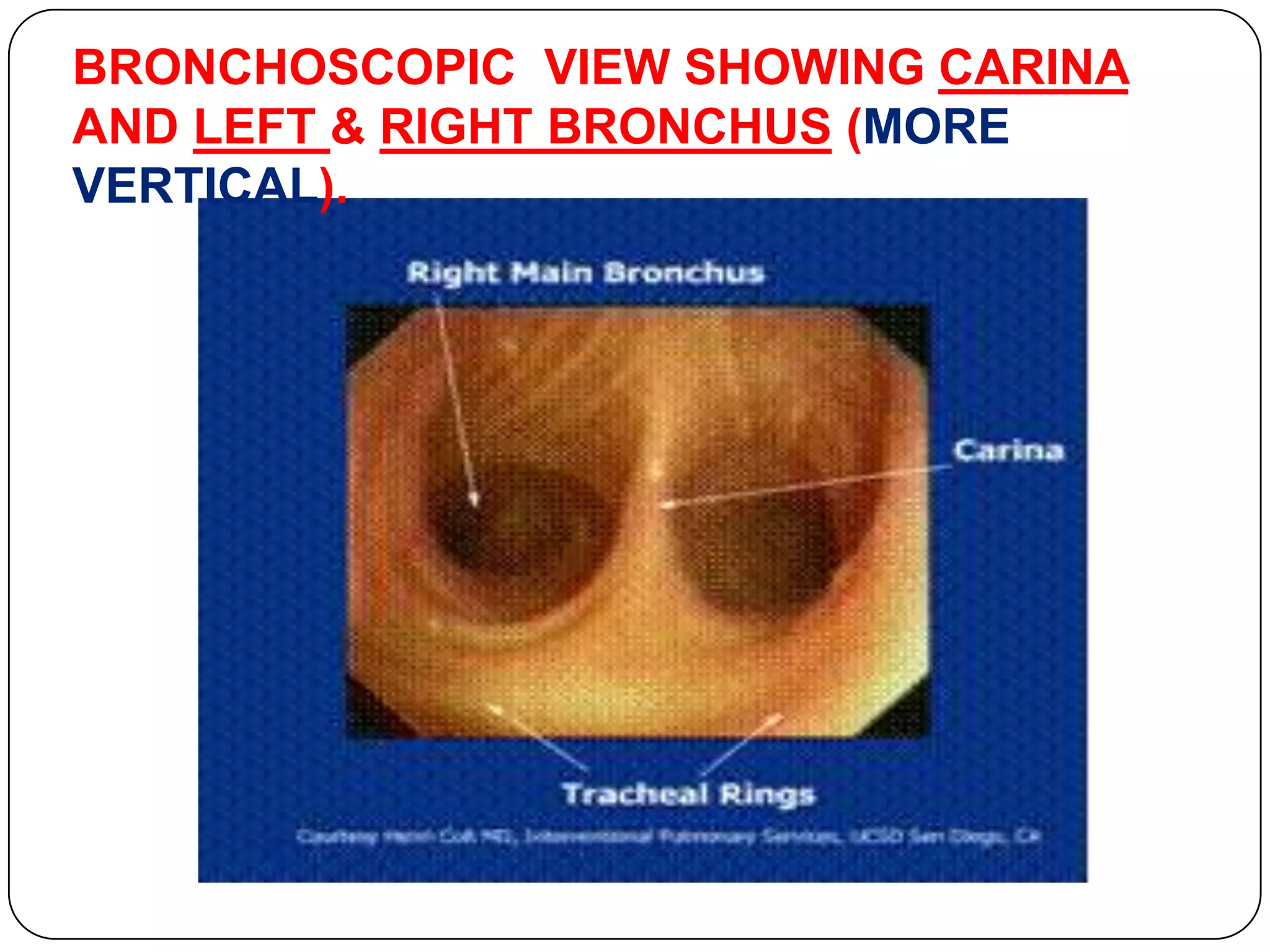 Anatomy of tracheobronchial tree | PPTX