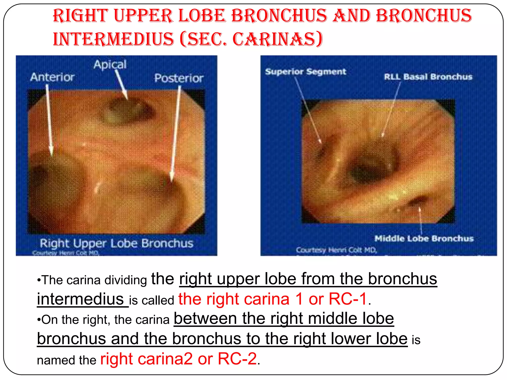 Anatomy of tracheobronchial tree | PPTX