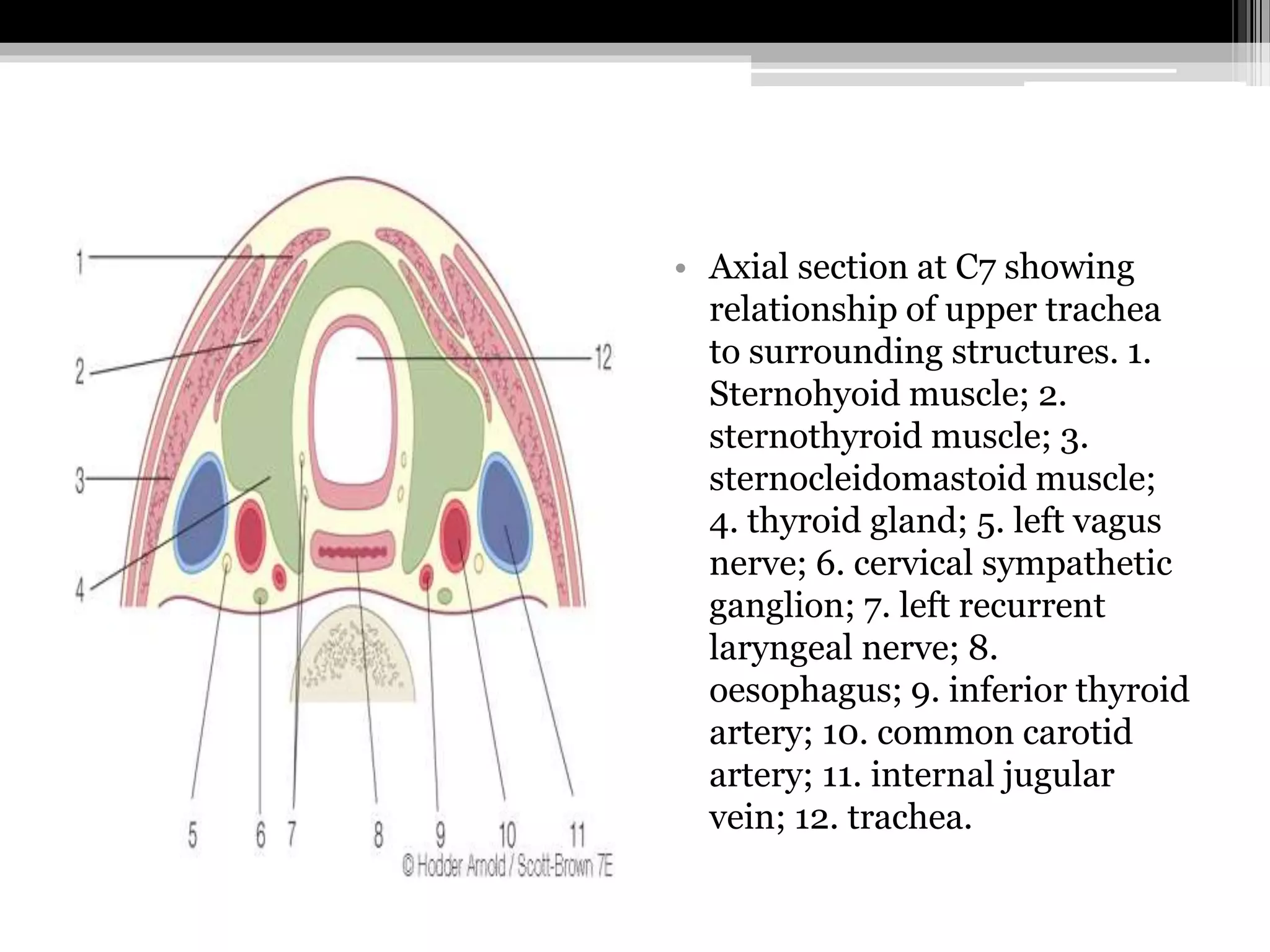 ANATOMY OF TRACHEOBRONCHIAL TREE.pptx