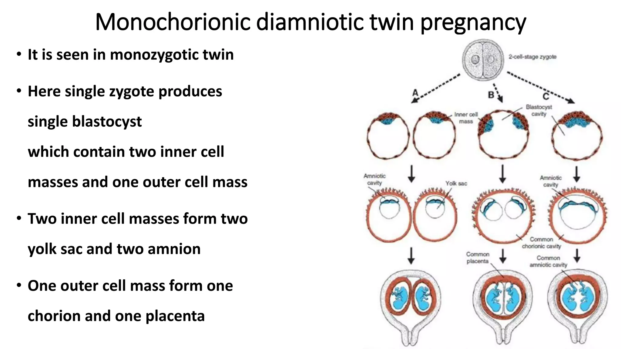 Anatomy of twin pregnancy | PPTX