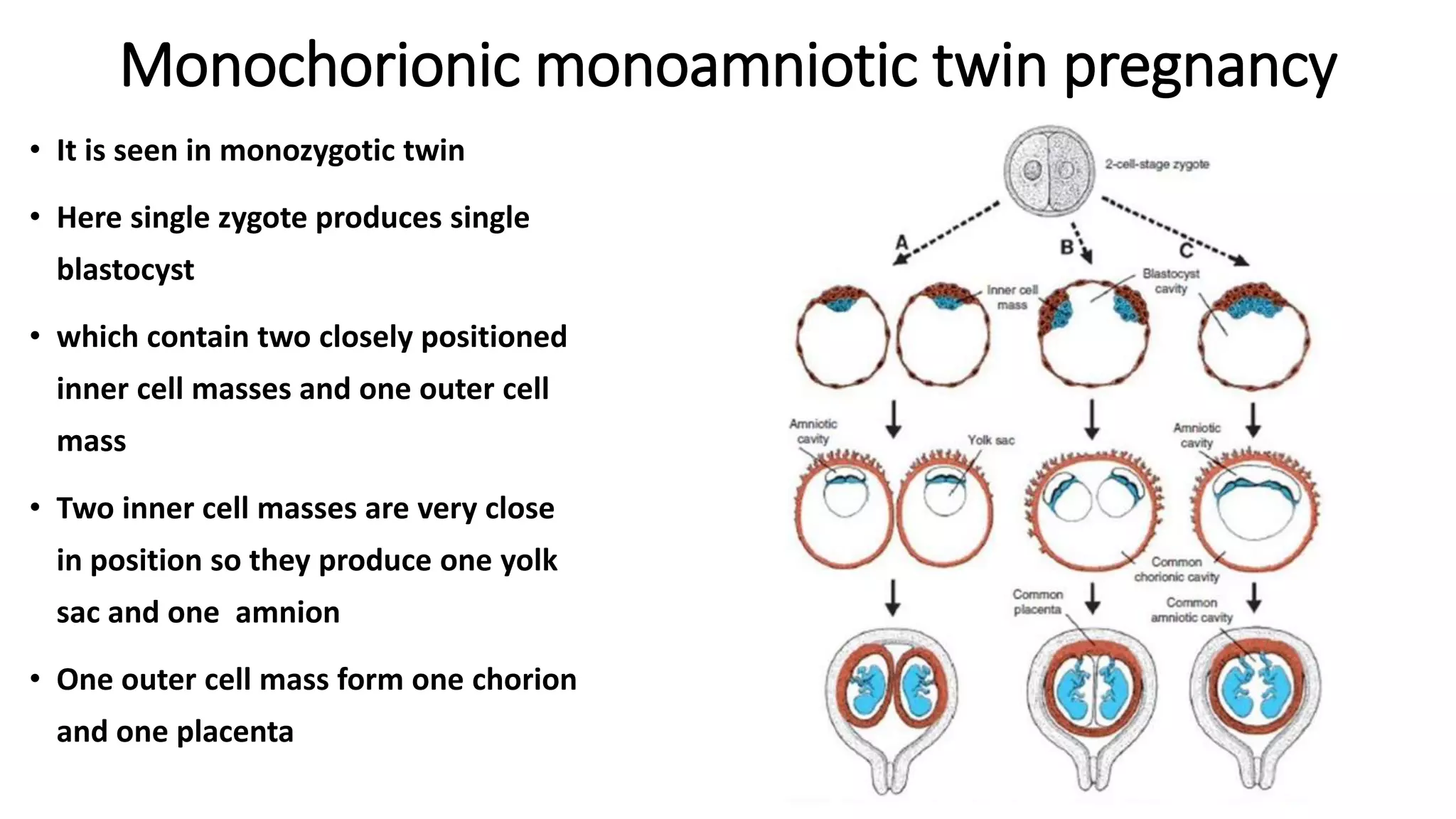 Anatomy of twin pregnancy | PPTX