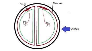 Anatomy of twin pregnancy | PPTX