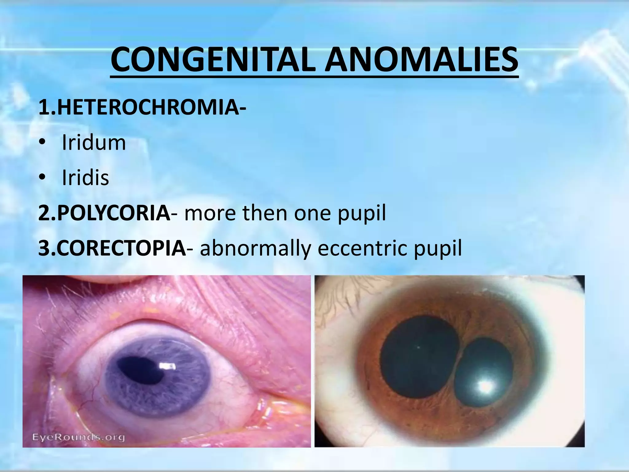 Anatomy of uvea | PPTX | Pregnancy | Reproductive Health