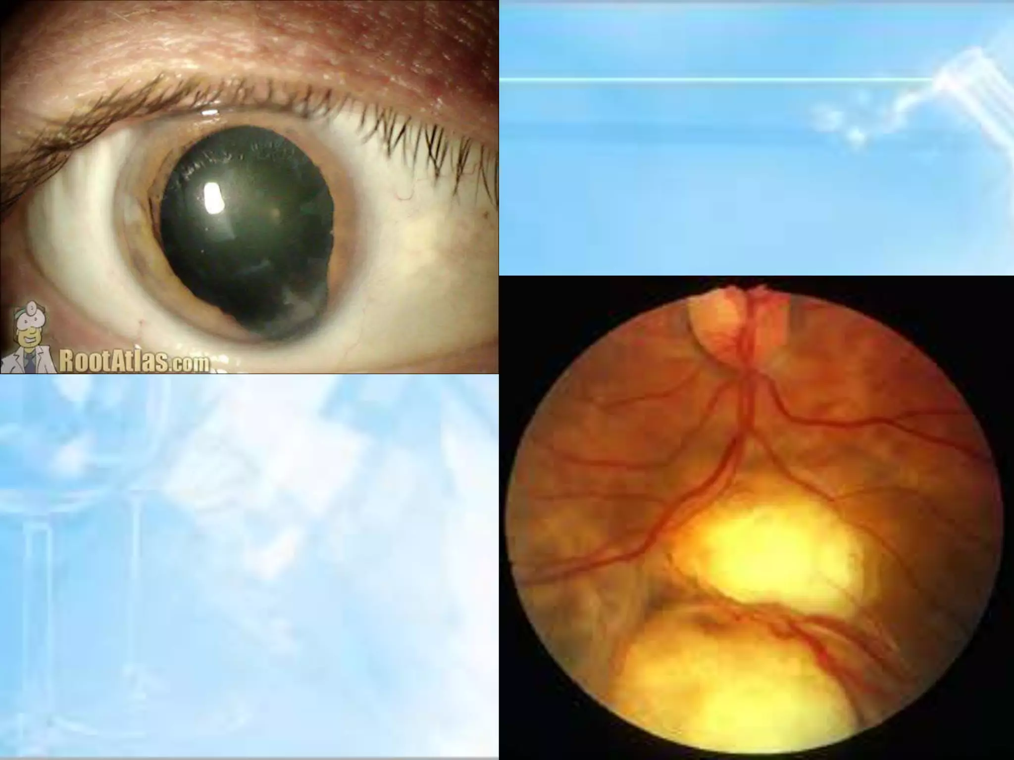 Anatomy of uvea | PPTX