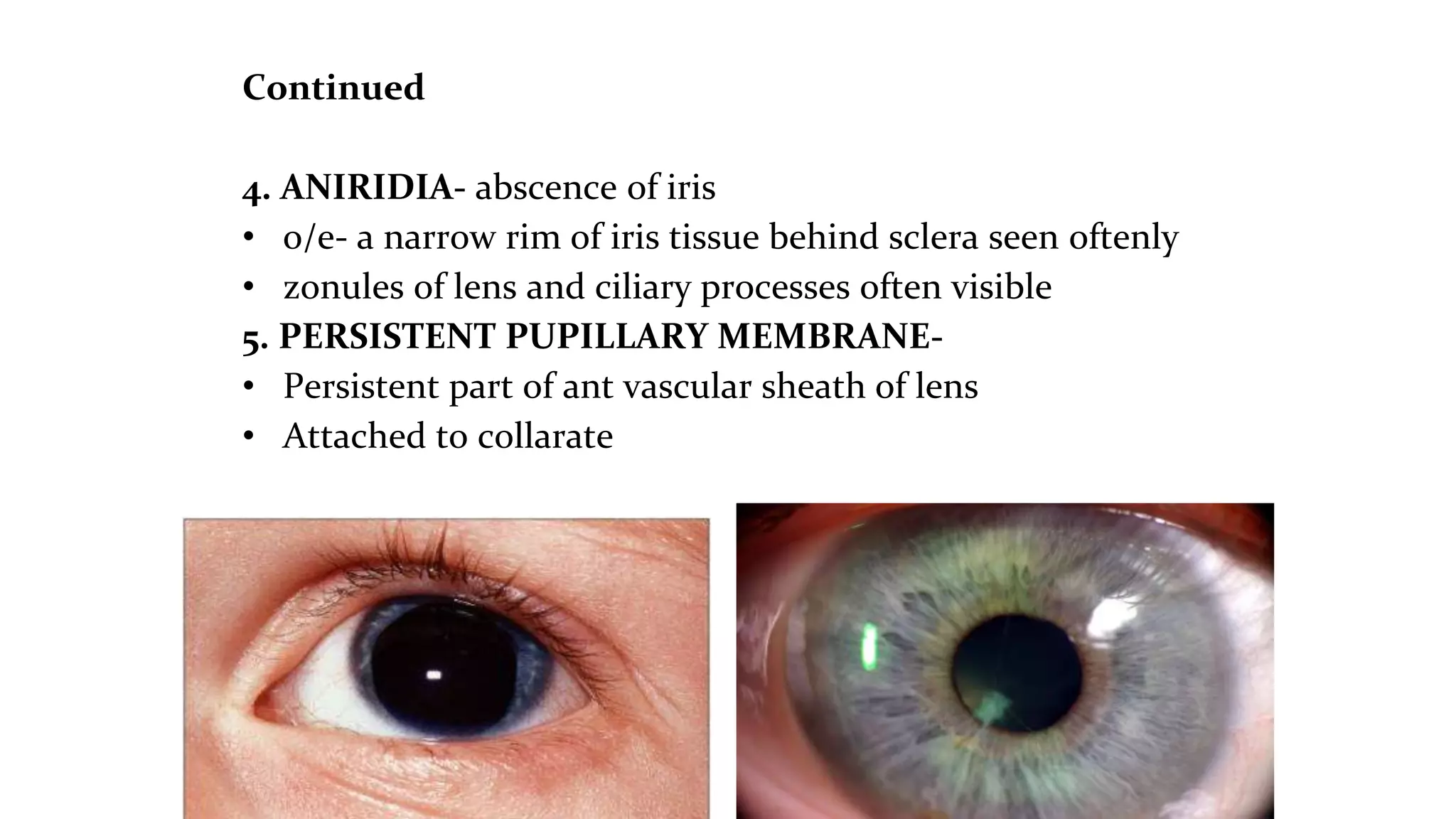 Anatomy of uvea | PPTX