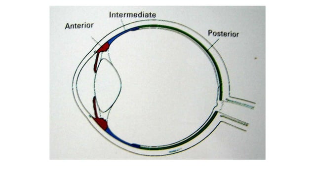 Anatomy of uvea | PPTX