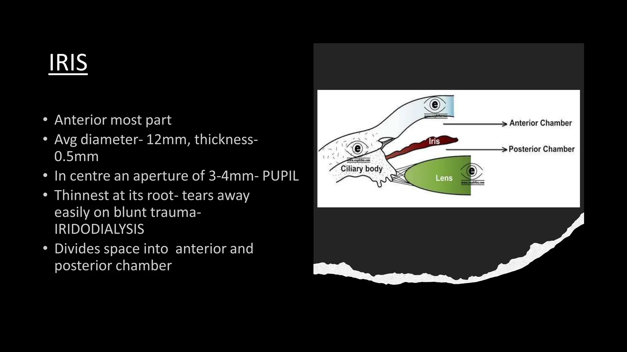 anatomyofuvea , iris , ciliary body , choroid | PPTX | Eye and Vision Conditions | Diseases and ...