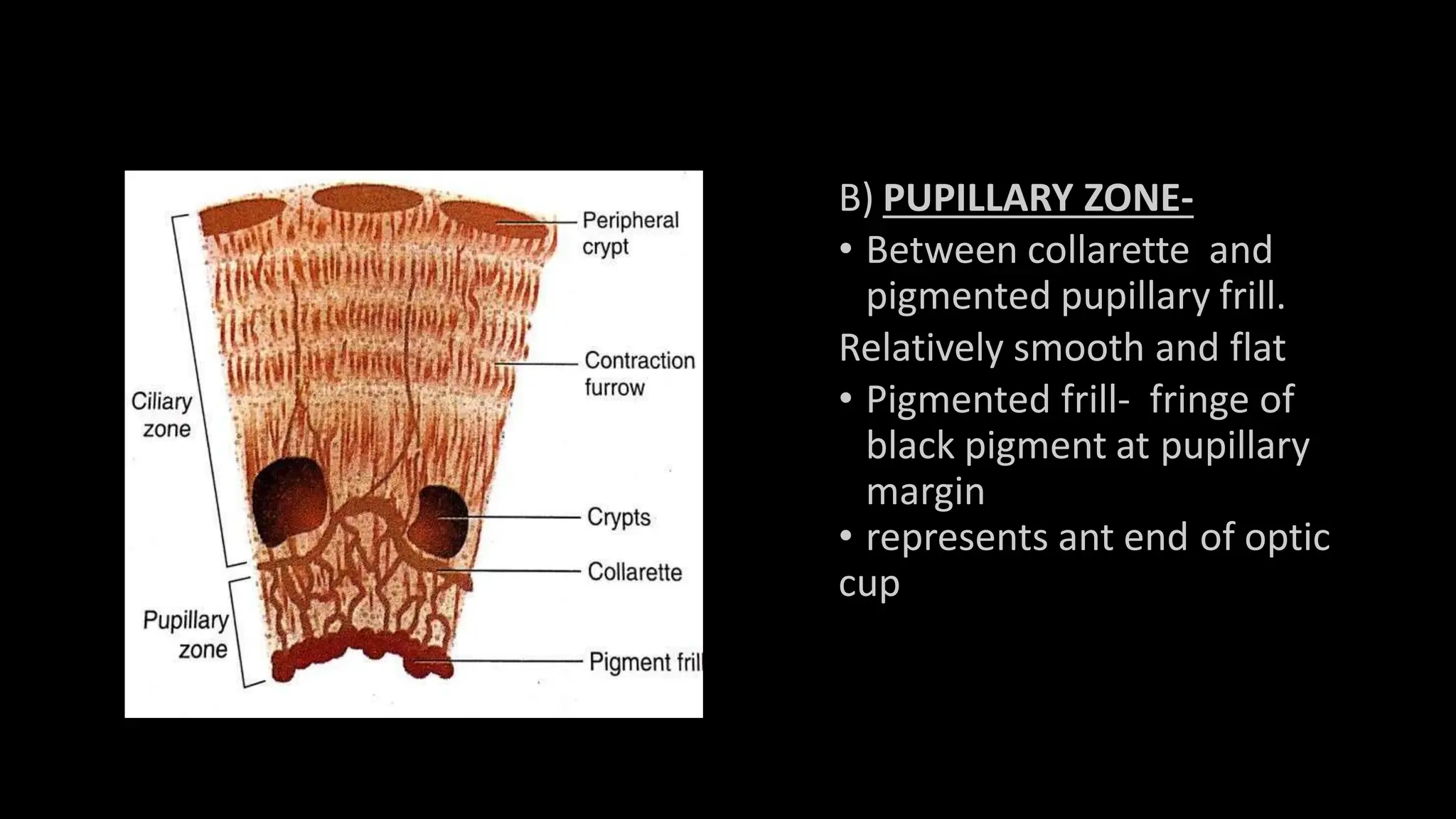 anatomyofuvea , iris , ciliary body , choroid | PPTX | Eye and Vision ...
