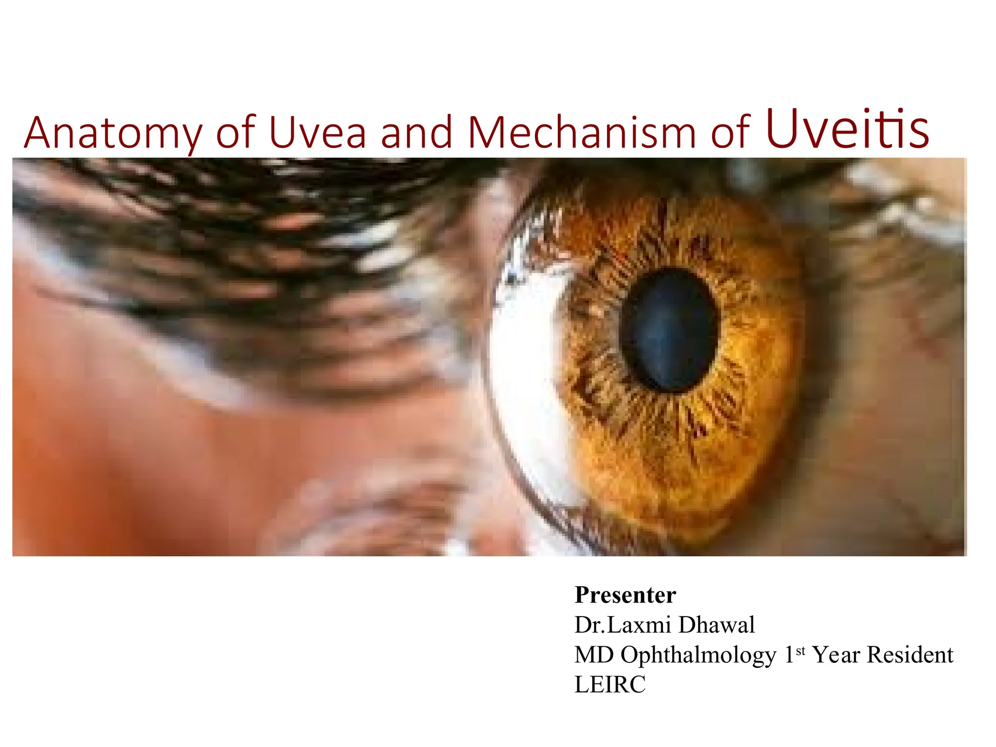 Anatomy of uvea and mechanism of uveitis.ppt