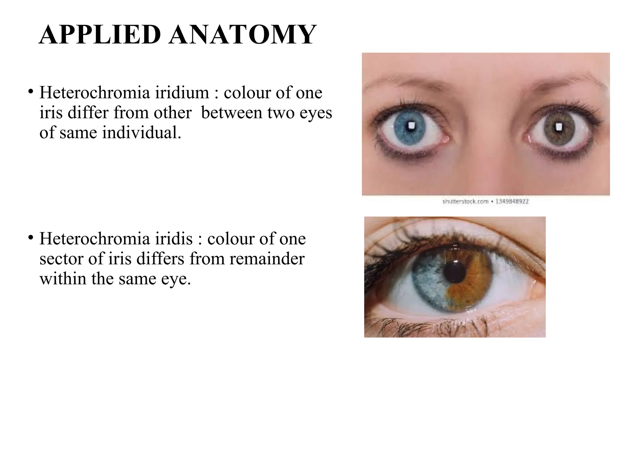 Anatomy of uvea and mechanism of uveitis.ppt