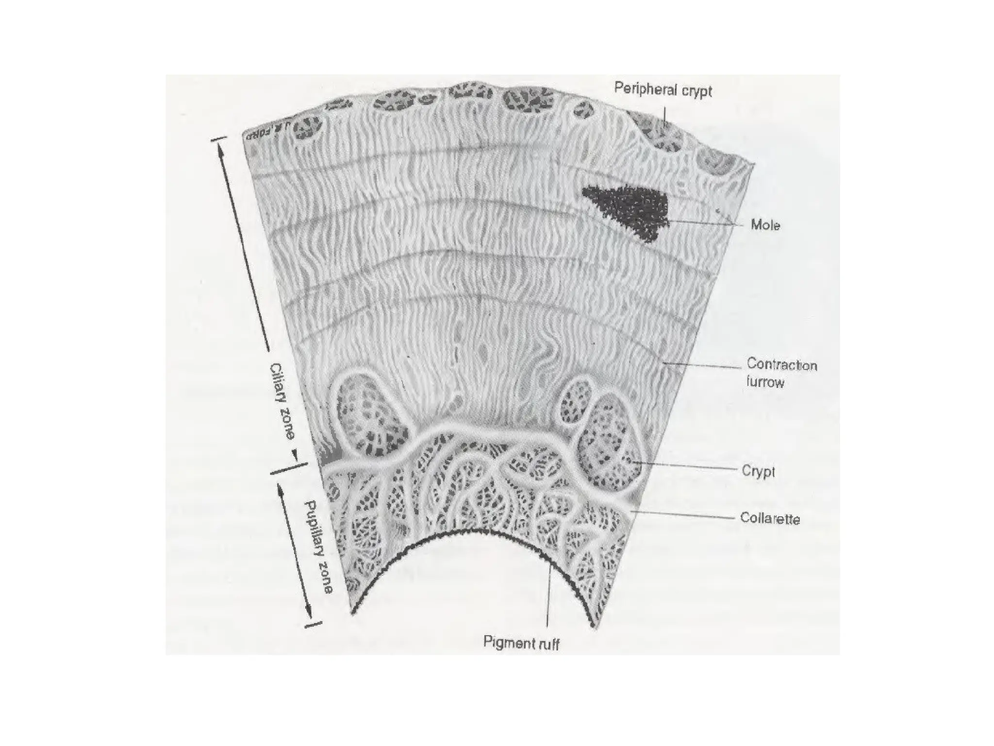 Anatomy of uvea and mechanism of uveitis.ppt