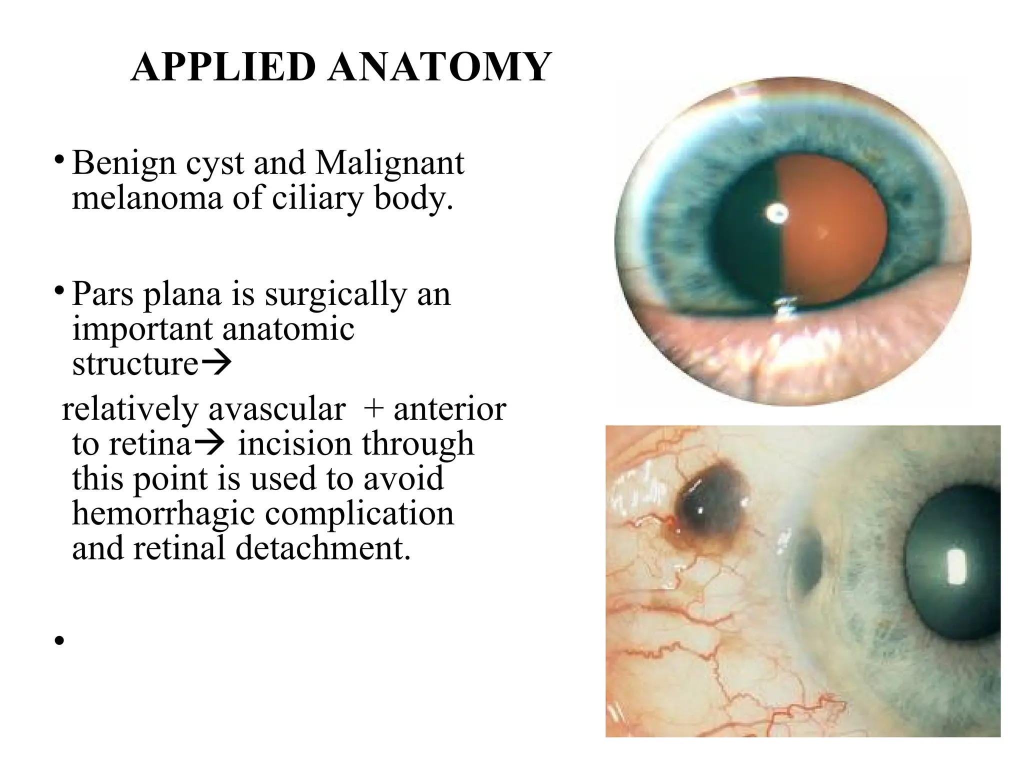 Anatomy of uvea and mechanism of uveitis.ppt