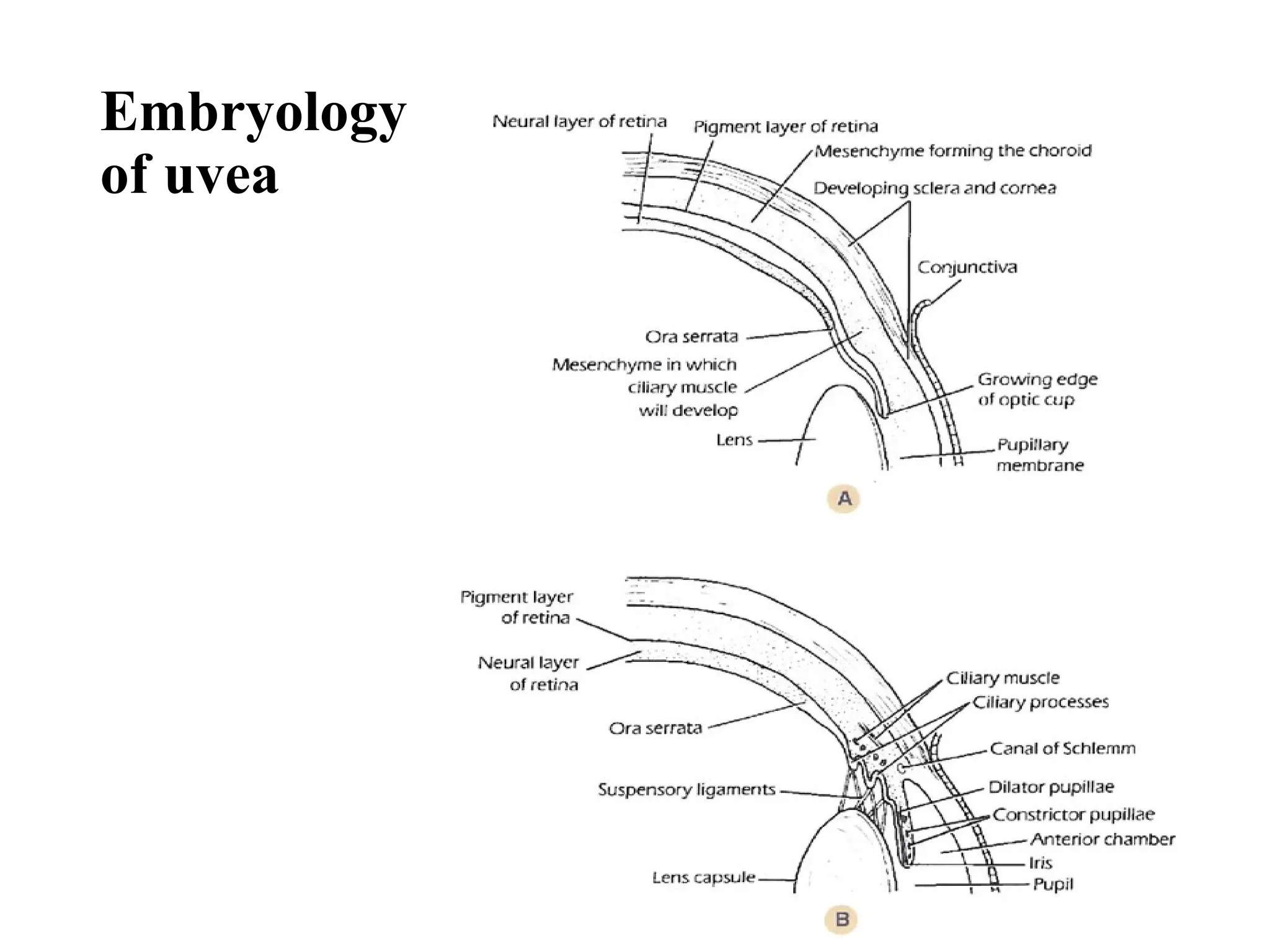 Anatomy of uvea and mechanism of uveitis.ppt