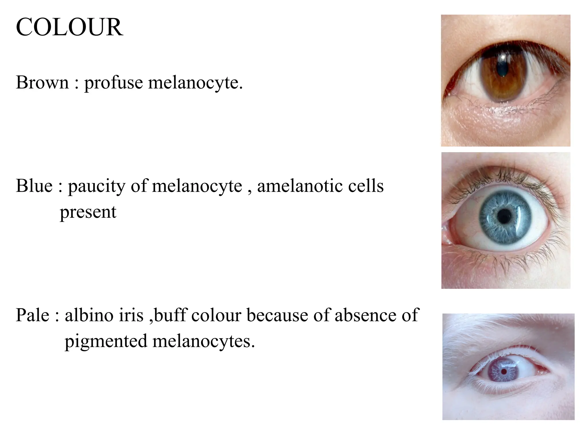 Anatomy of uvea and mechanism of uveitis.ppt