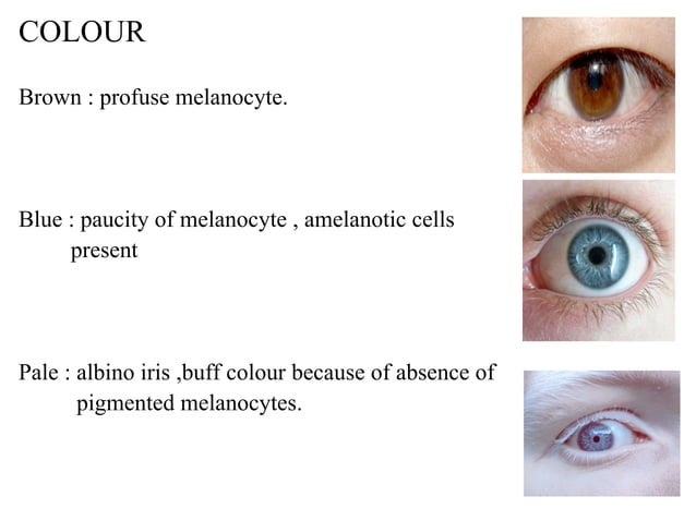 Anatomy of uvea and mechanism of uveitis.ppt