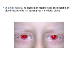 Anatomy of uvea and mechanism of uveitis.ppt